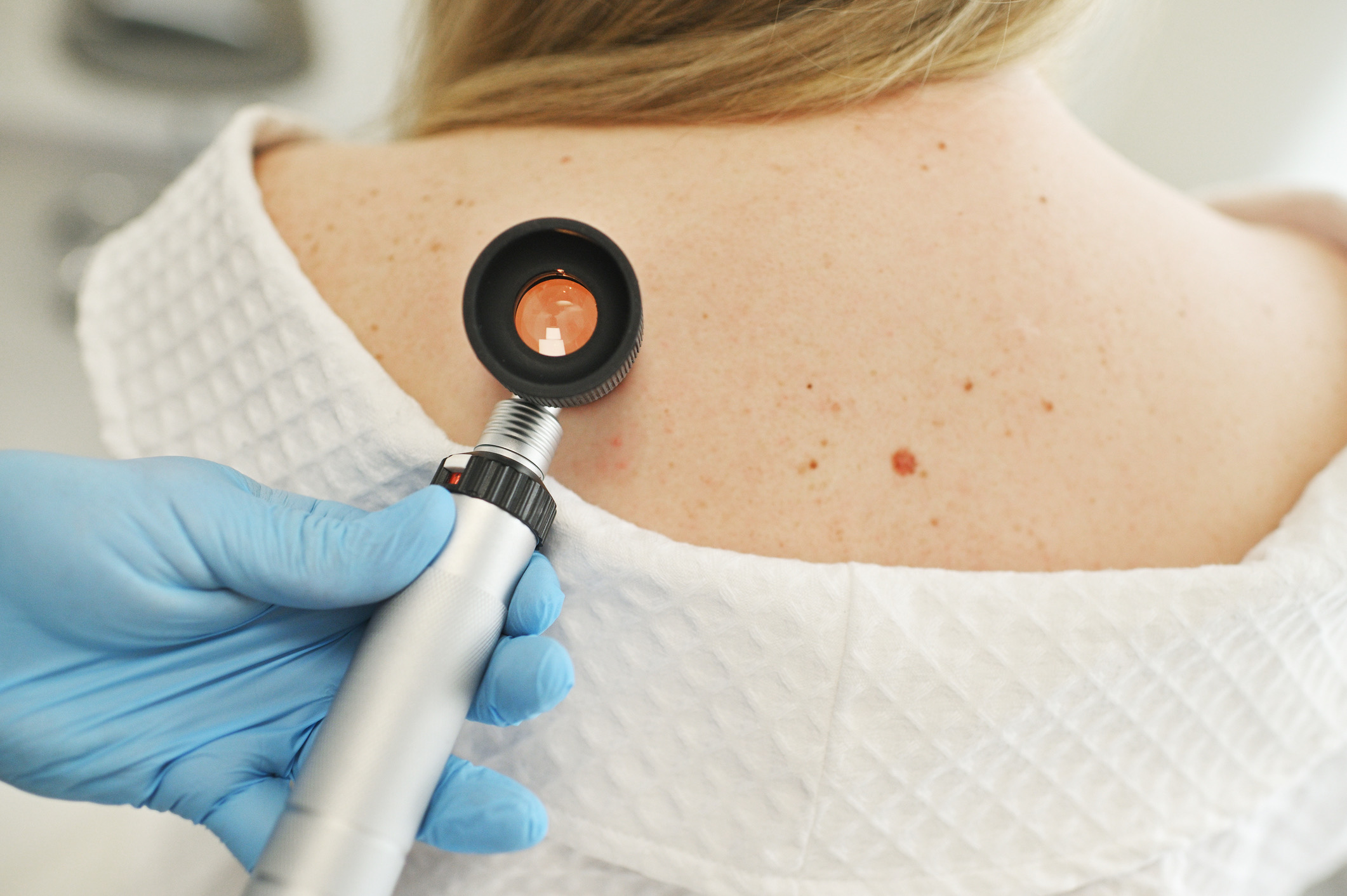 When to See a Dermatologist for Skin Cancer Screening in Jacksonville ...